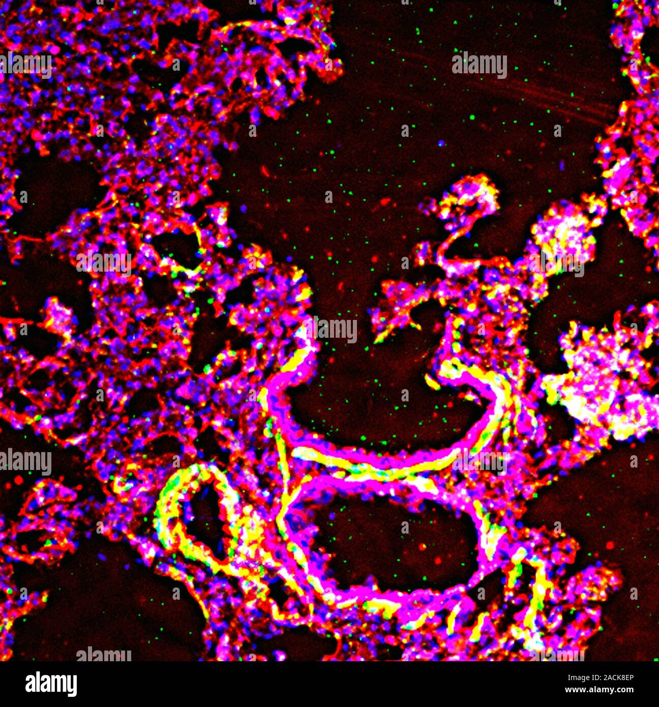 Le tissu pulmonaire. La déconvolution de fluorescence d'une ...
