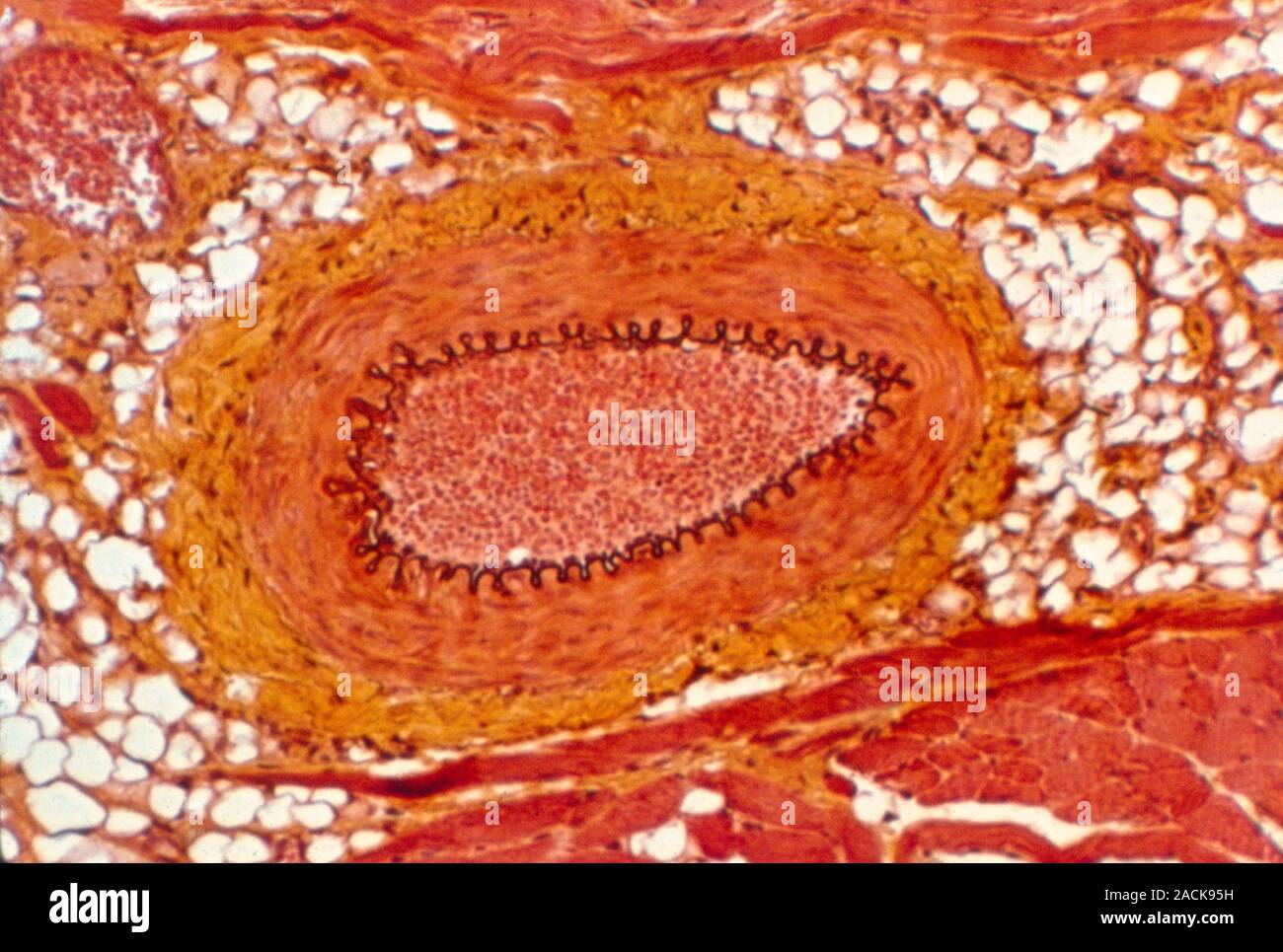 Section de veine, lumière microphotographie. C'est une section par une ...