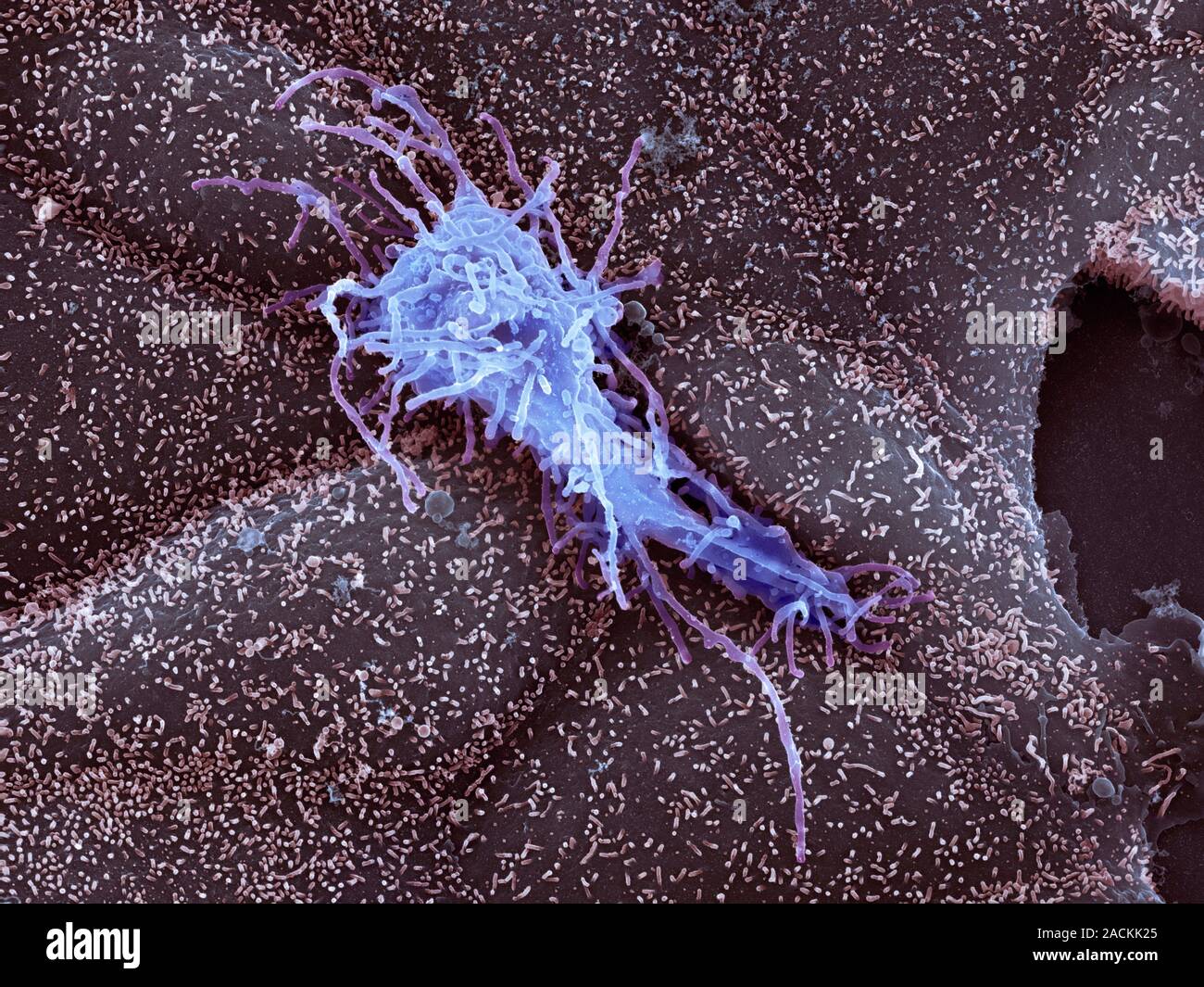 Des cellules HeLa. Couleur de l'analyse des électrons Microphotographie ...