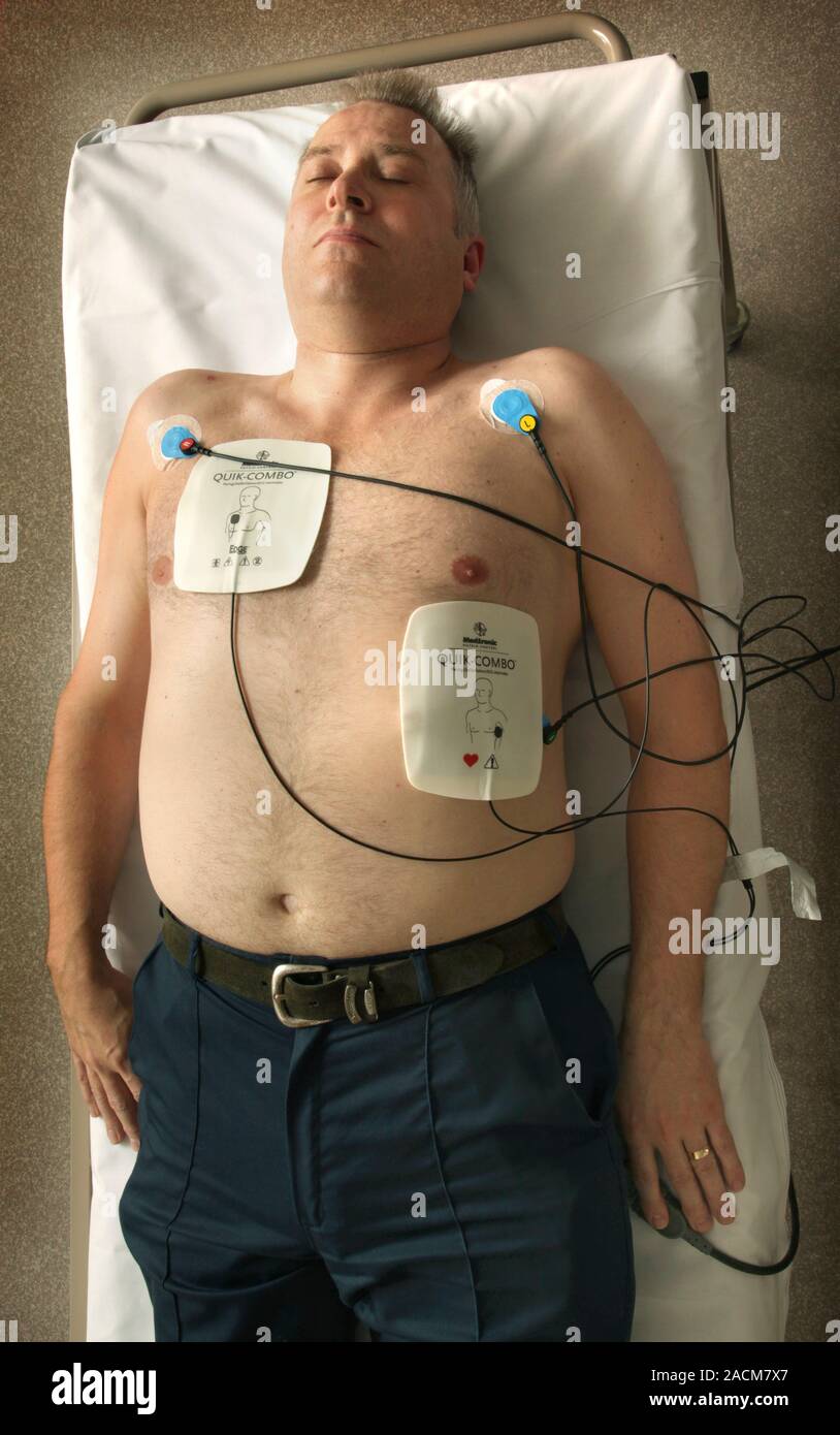 Homme attaque cardiaque (arrêt cardiaque) patient est allongé sur un ...