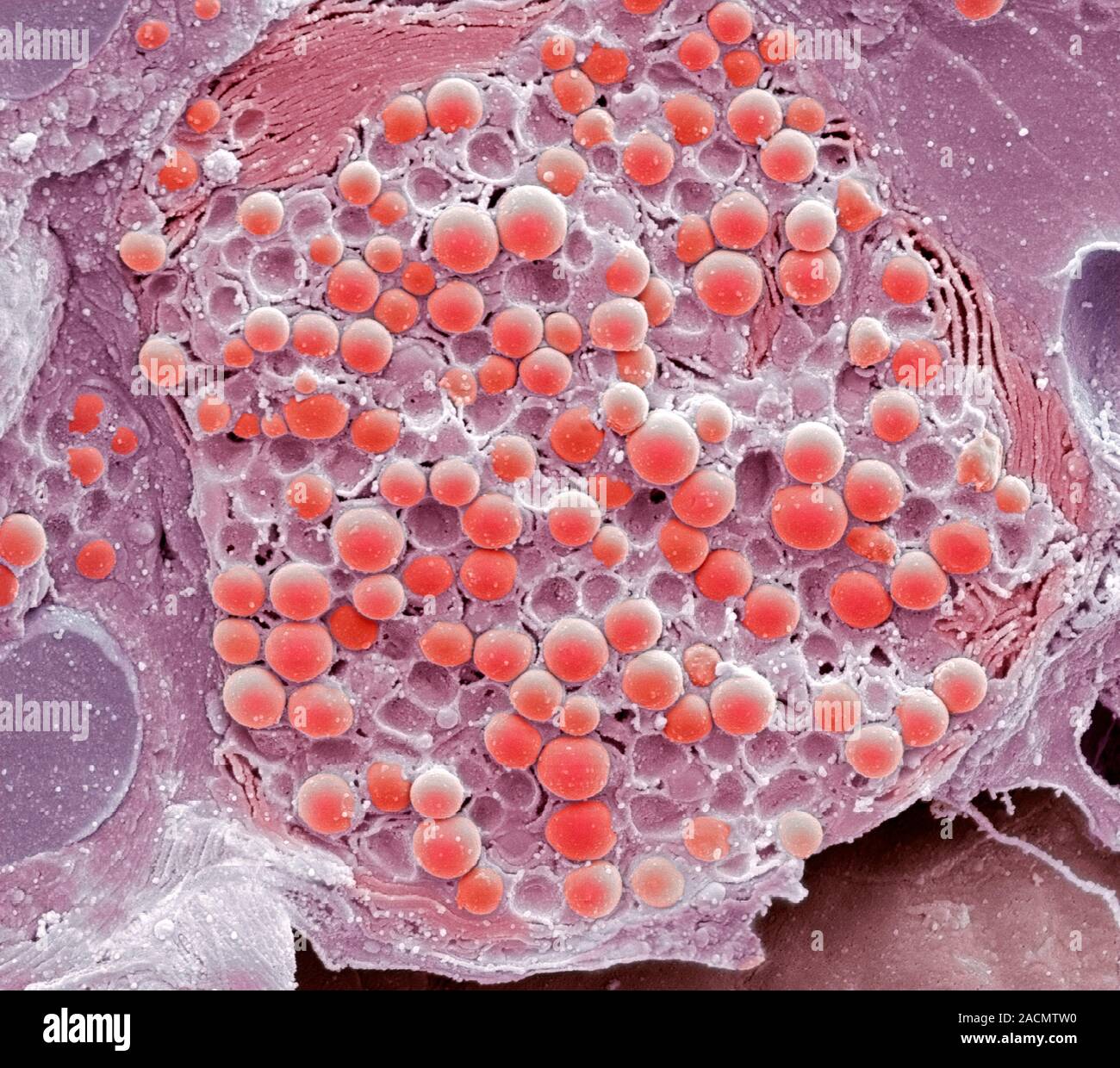 Glande salivaire. Couleur de l'analyse des électrons Microphotographie ...