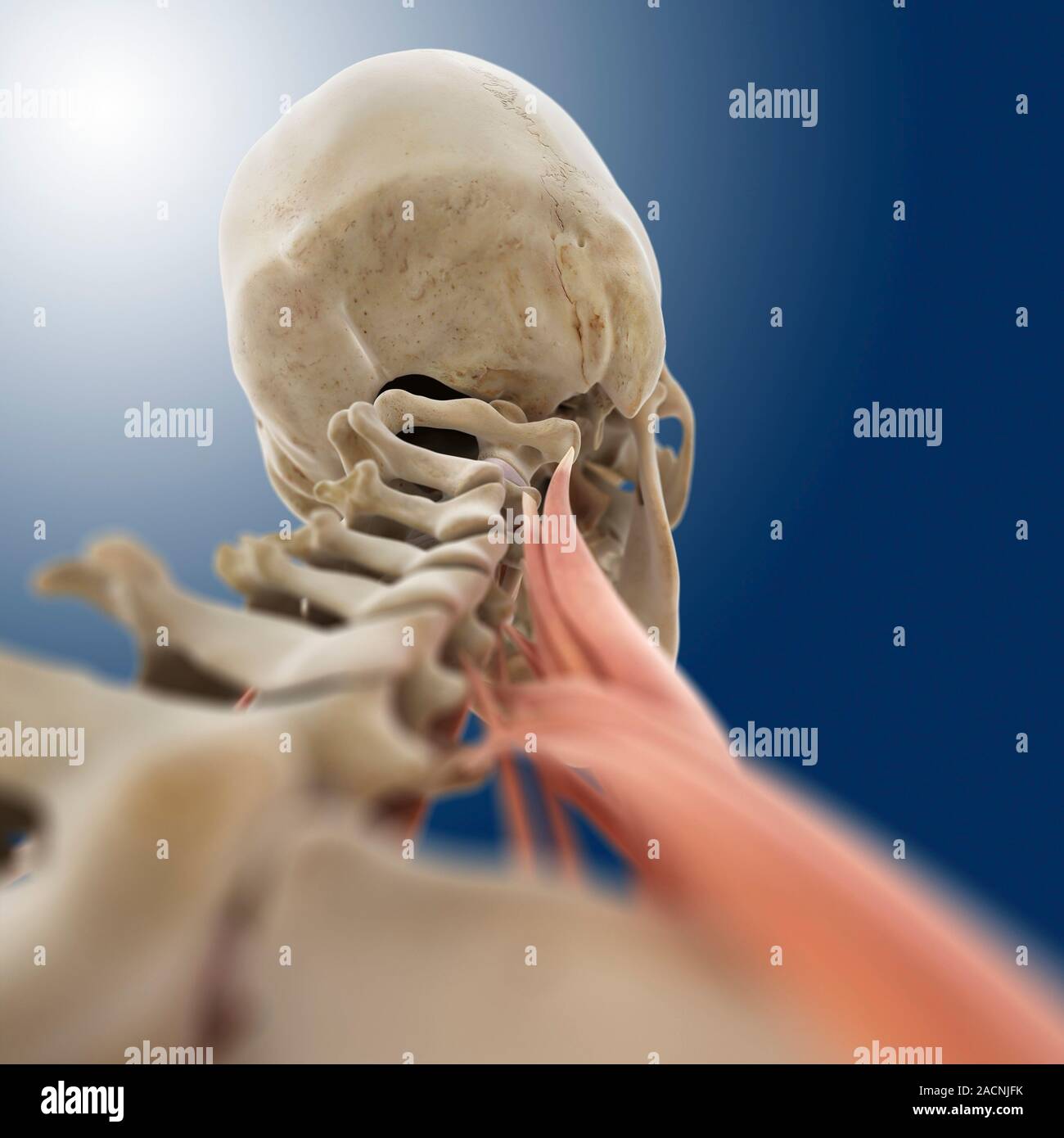 Les muscles du cou, de l'oeuvre de l'ordinateur. Les muscles de chaque ...