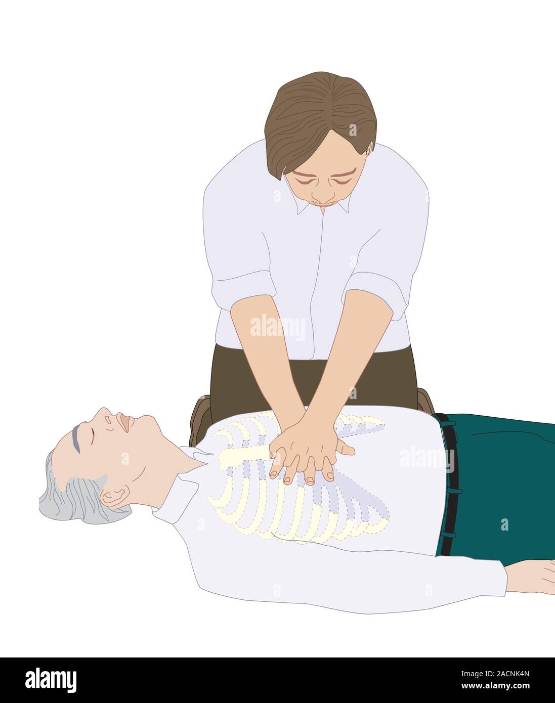 Premiers soins RCR technique. Artwork montrant la 6e de 6 étapes ...