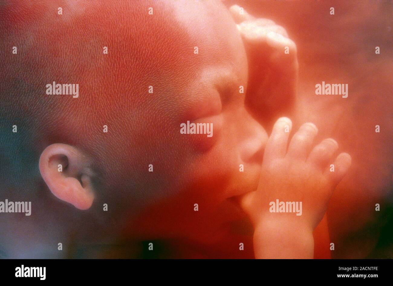 Foetus Humain Dans Lutérus 19 Semaines Foetus Humain Suçant Son Pouce Dans Lutérus Un Foetus