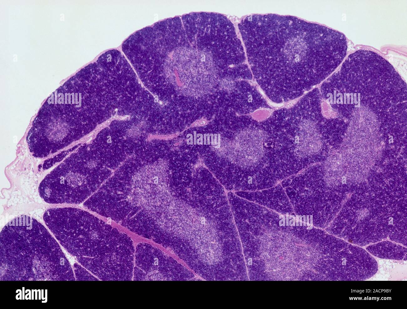 Thymus. Microphotographie lumière d'une section à travers les tissus de ...