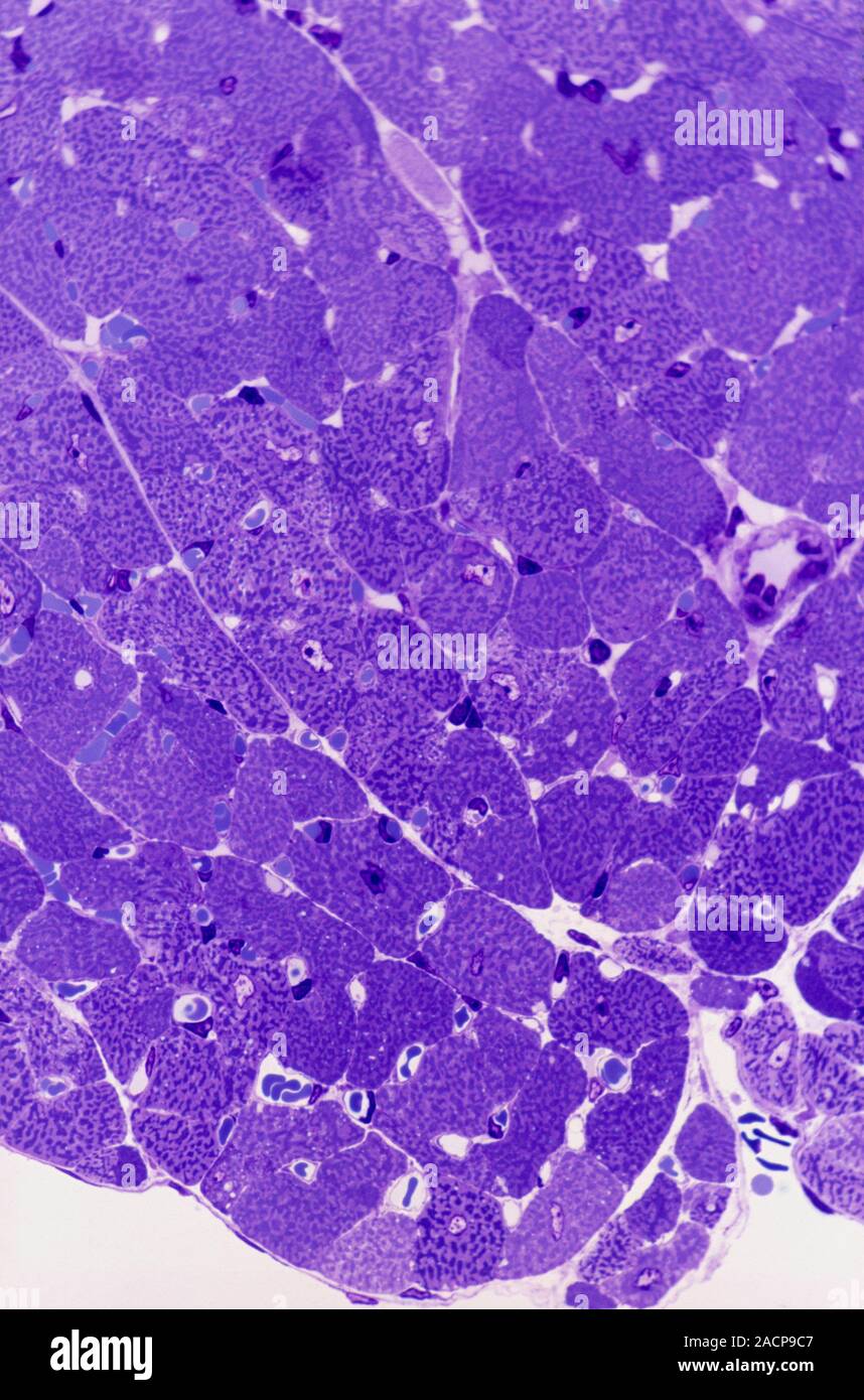 Le muscle cardiaque. Microphotographie lumière d'une section à travers ...