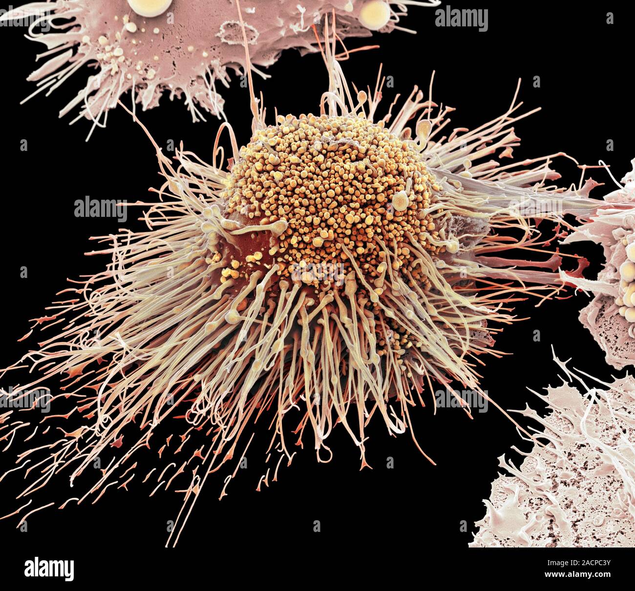 Macrophage activé. Couleur de l'analyse des électrons Microphotographie ...