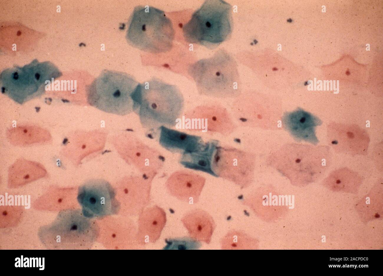 Frottis cervical sain. Microphotographie lumière saine des cellules ...