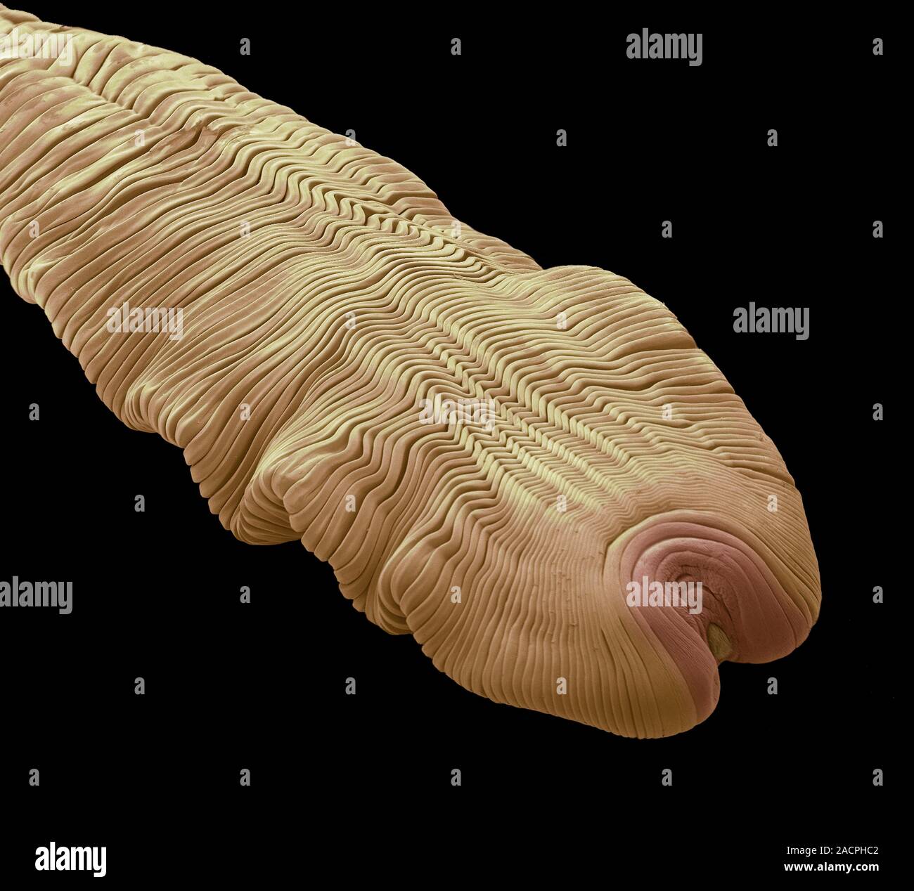 La tête du ténia. Couleur de l'analyse des électrons Microphotographie ...