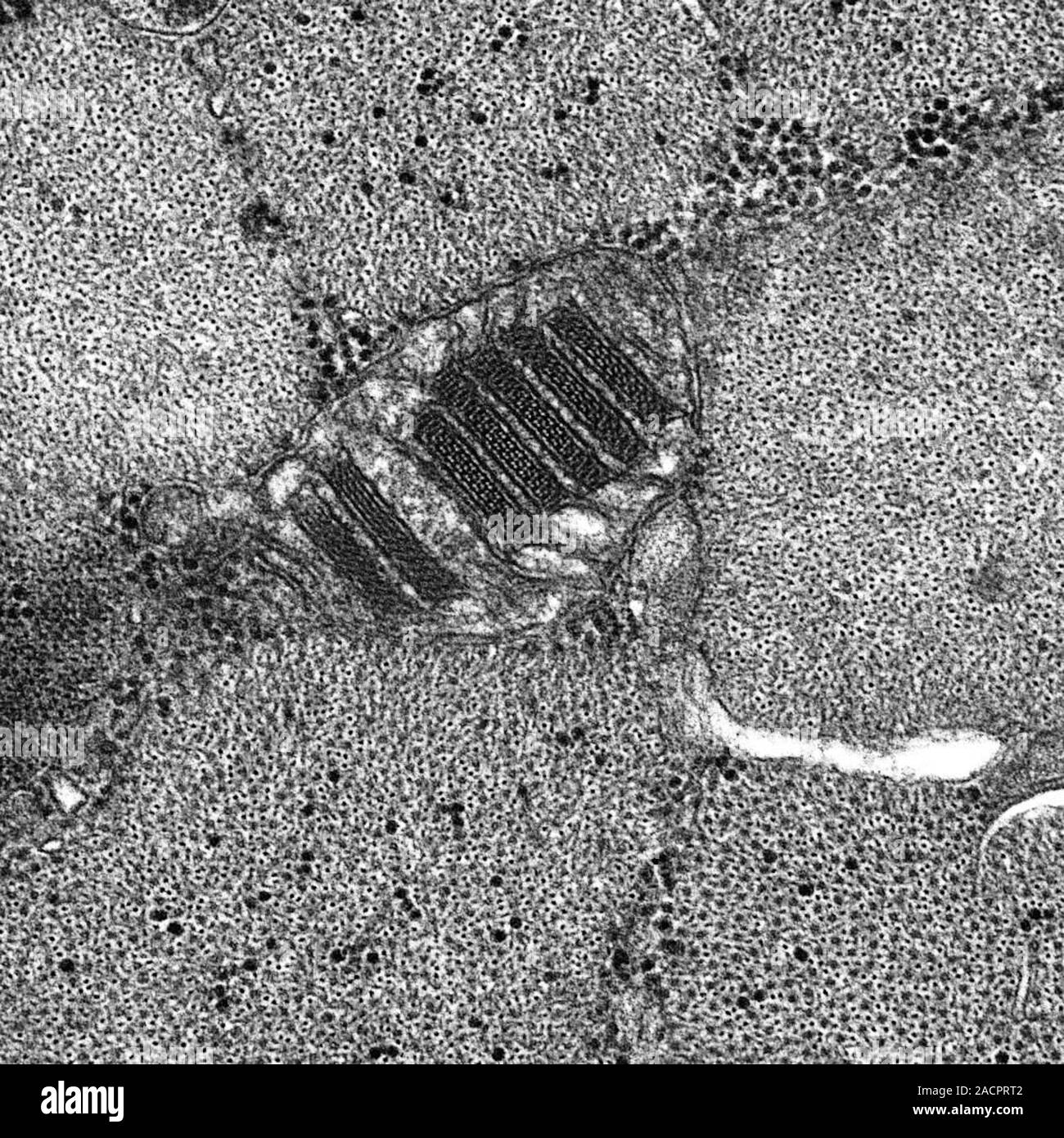 Inclusions mitochondriales. Micrographie électronique à transmission ...