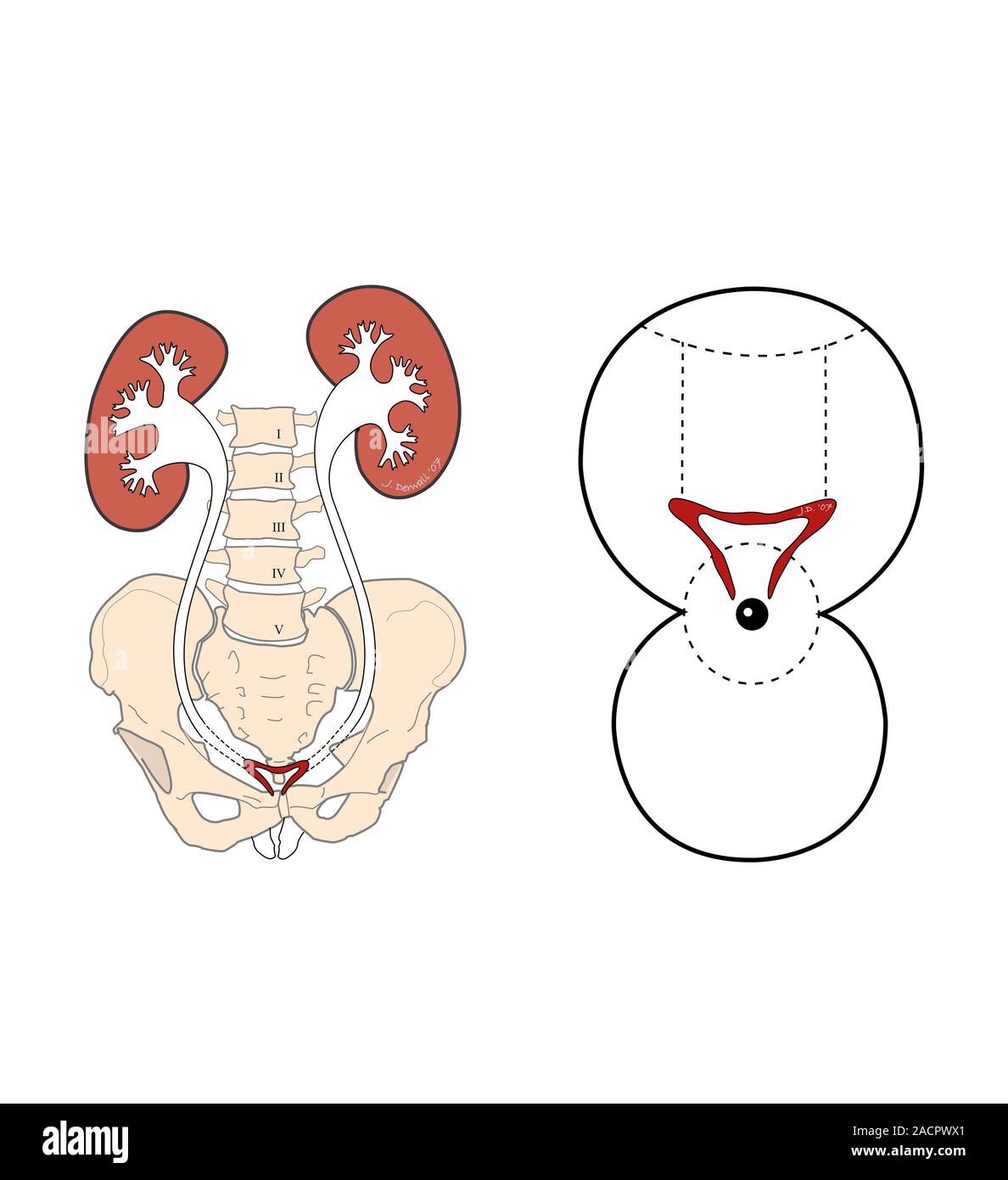 La chirurgie d'Incontinence. Œuvres de la région sacrée d'un bassin de ...