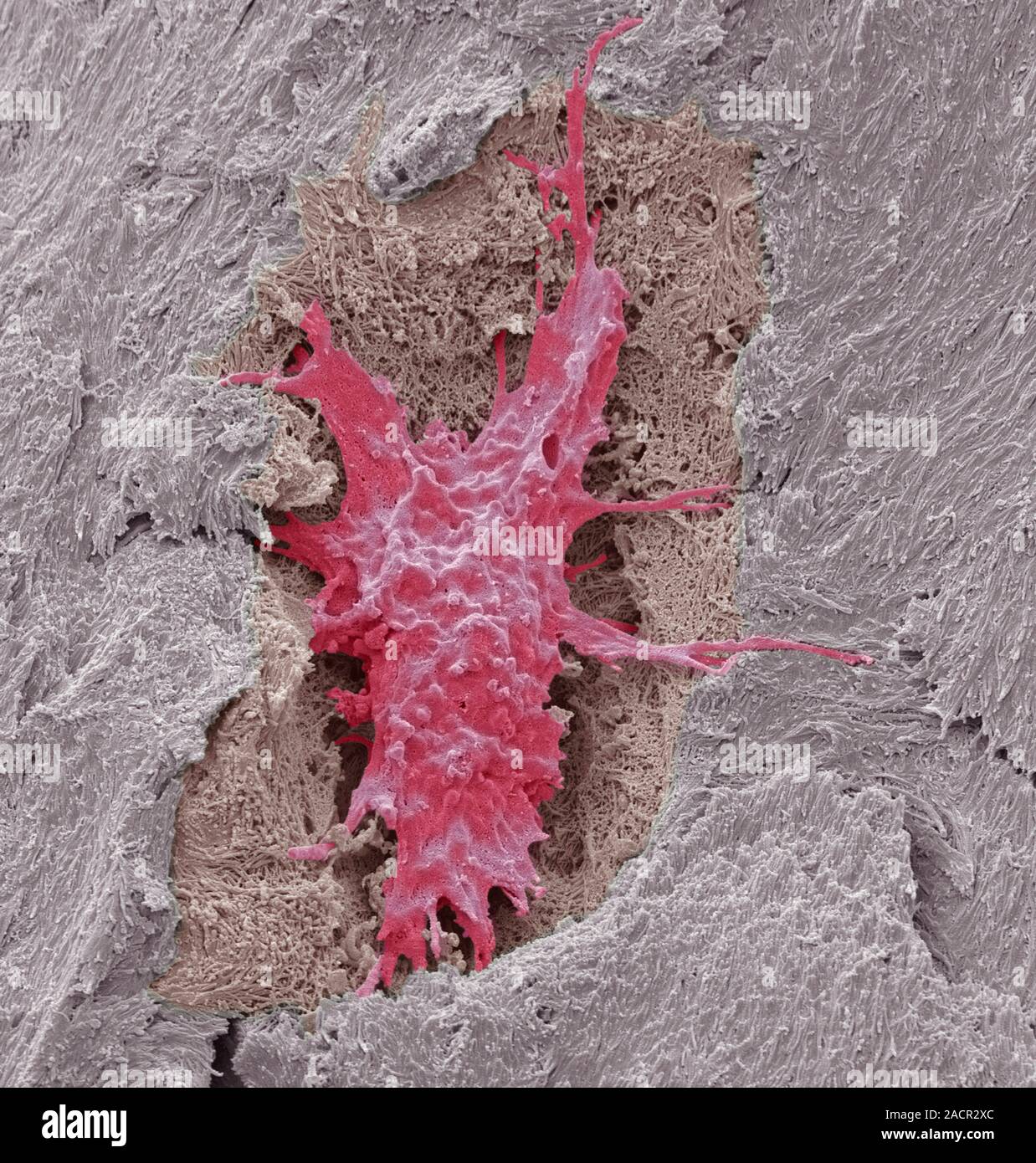 Osteocyte cellule osseuse. Couleur de l'analyse des électrons ...