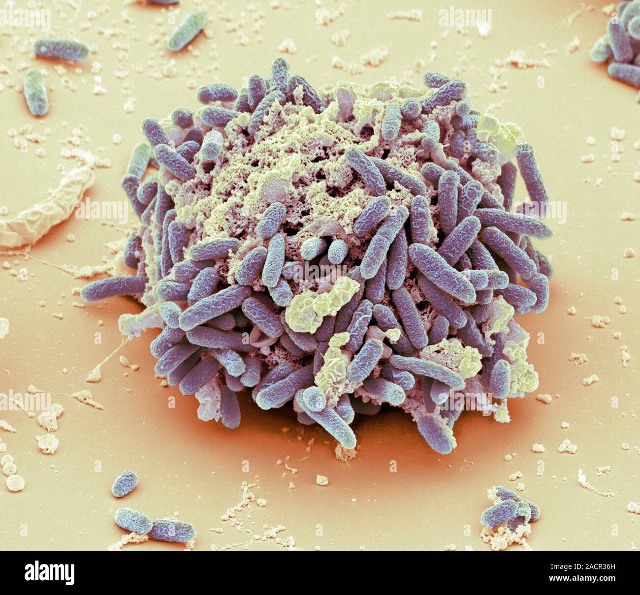 La bactérie E. coli. Couleur de l'analyse des électrons ...