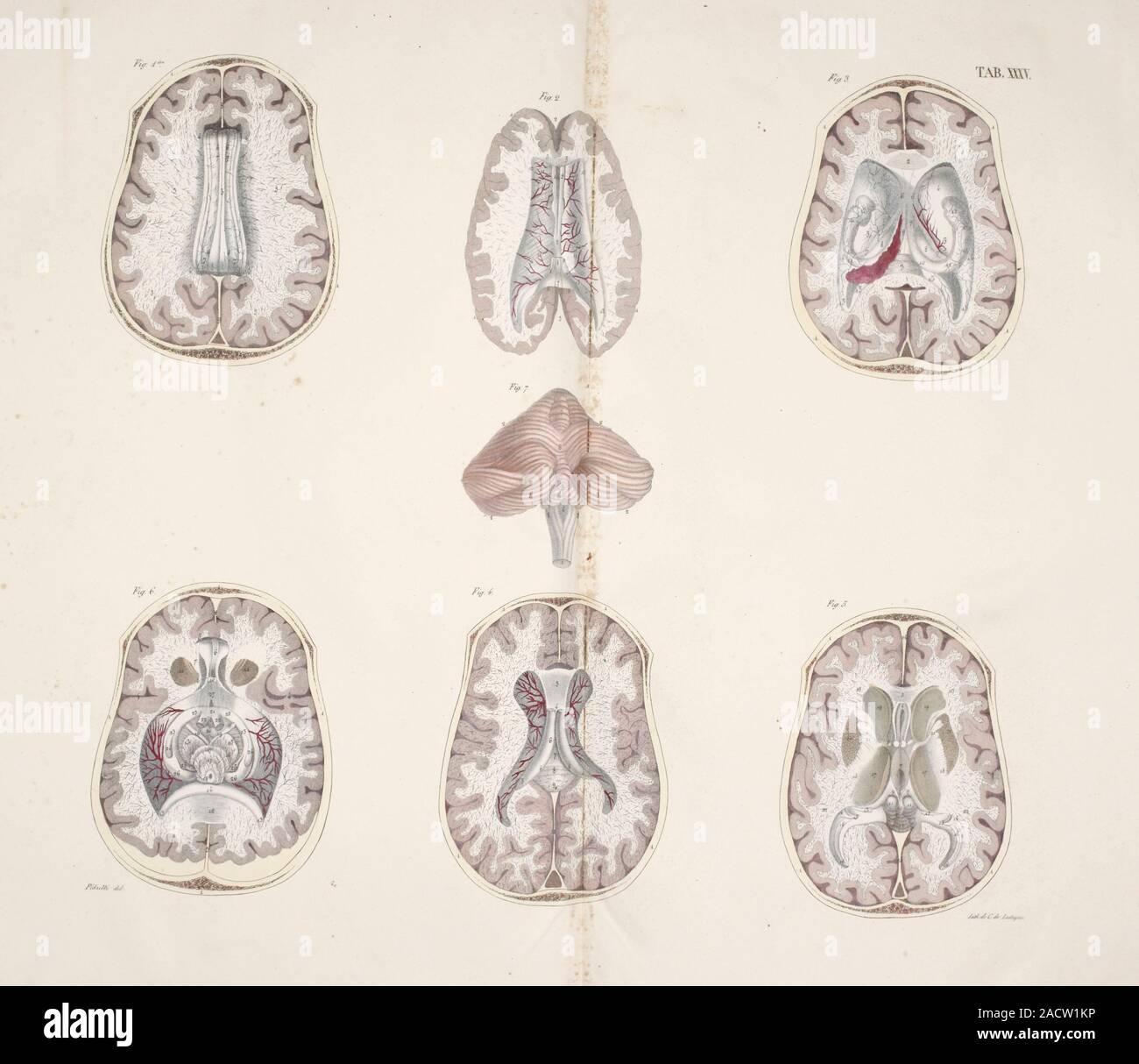 Dessin anatomique de section transversale du cerveau, de l'impression ...