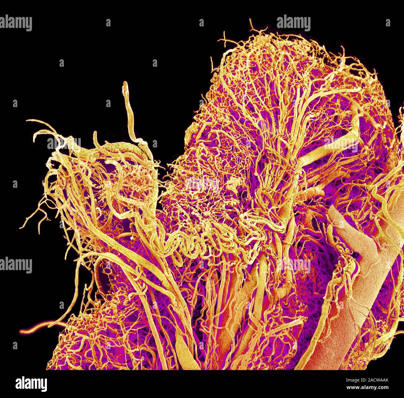 Les vaisseaux sanguins. Couleur de l'analyse des électrons ...