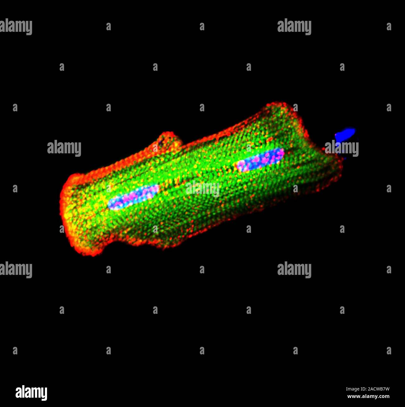 Des cellules du muscle cardiaque. Micrographie de déconvolution de ...