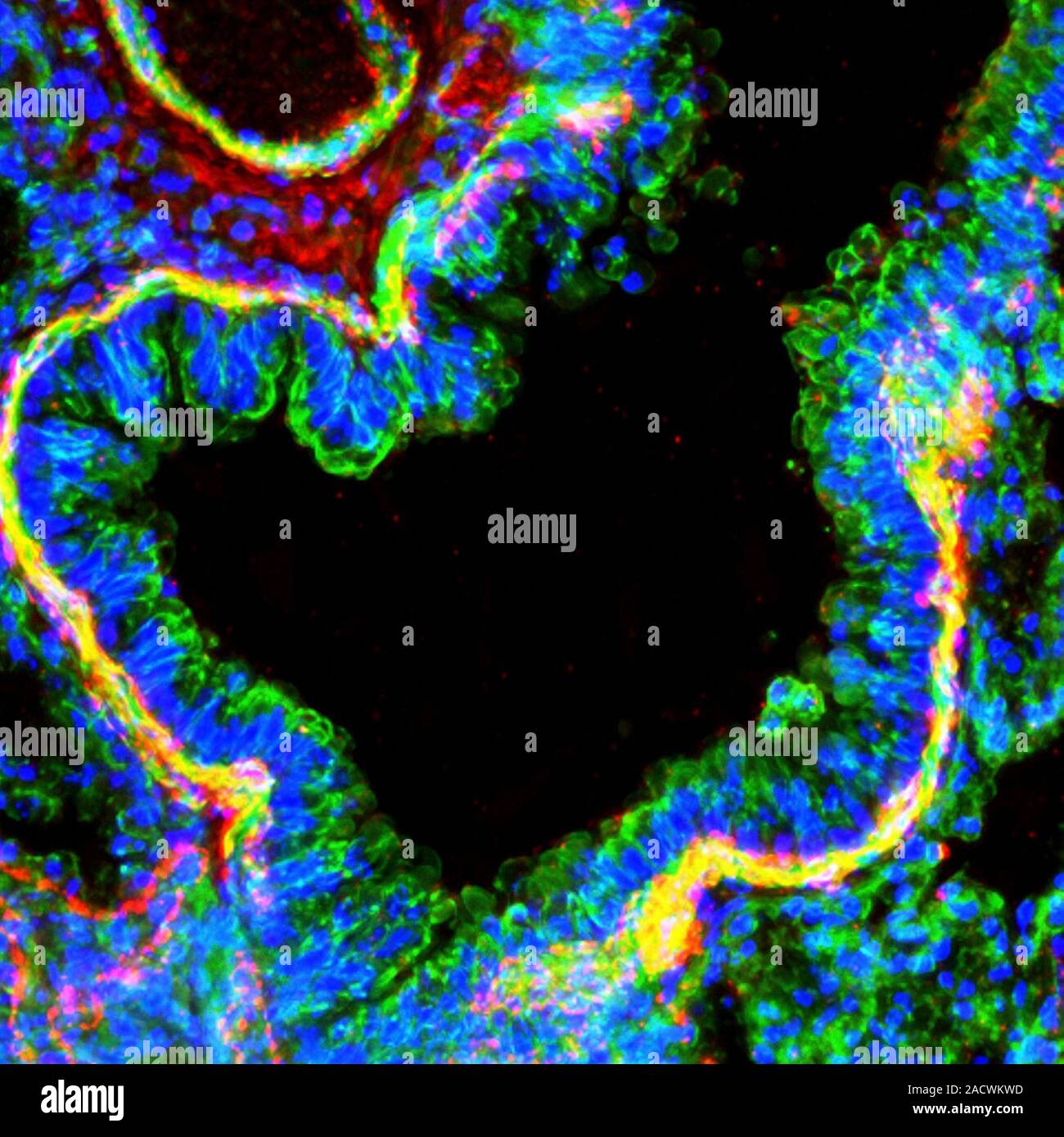 Bronchioles respiratoires. La déconvolution de fluorescence d'une ...