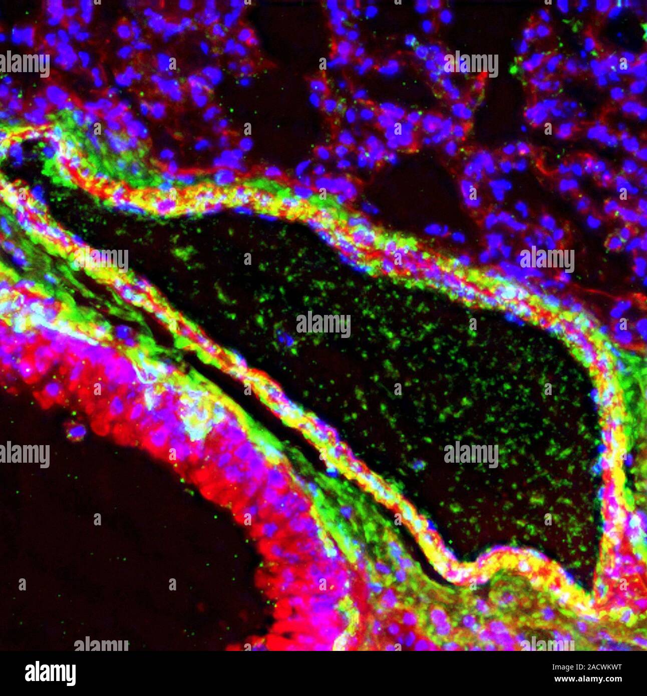 L'artère pulmonaire. La déconvolution de fluorescence d'une ...