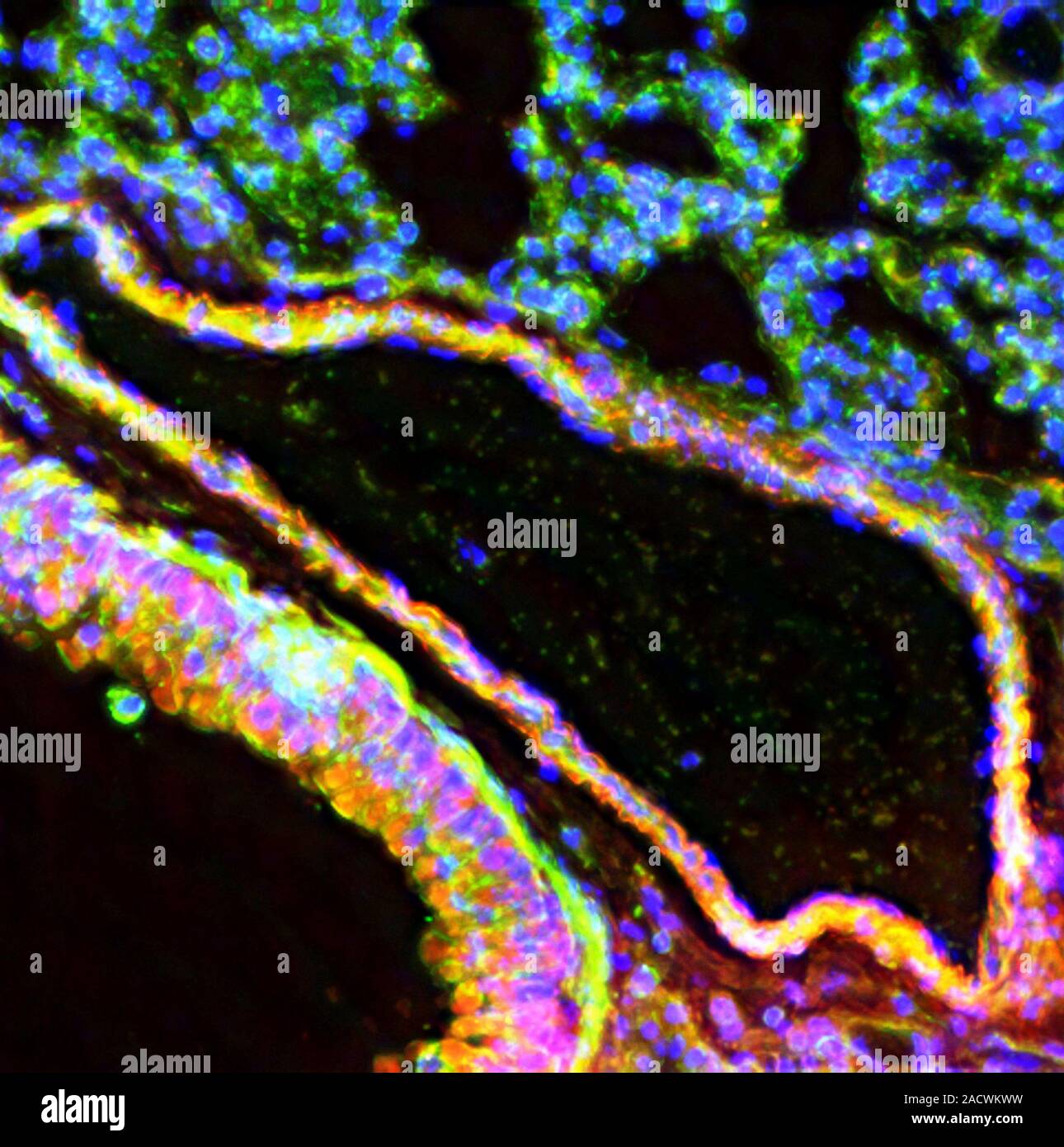 L'artère pulmonaire. La déconvolution de fluorescence d'une ...