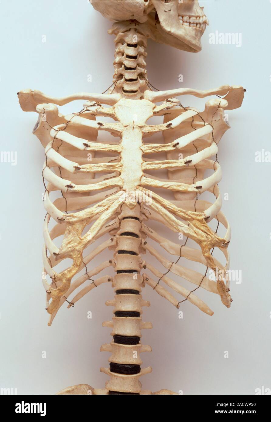 La cage thoracique, mâchoires, vertèbres du cou menant au sternum ...