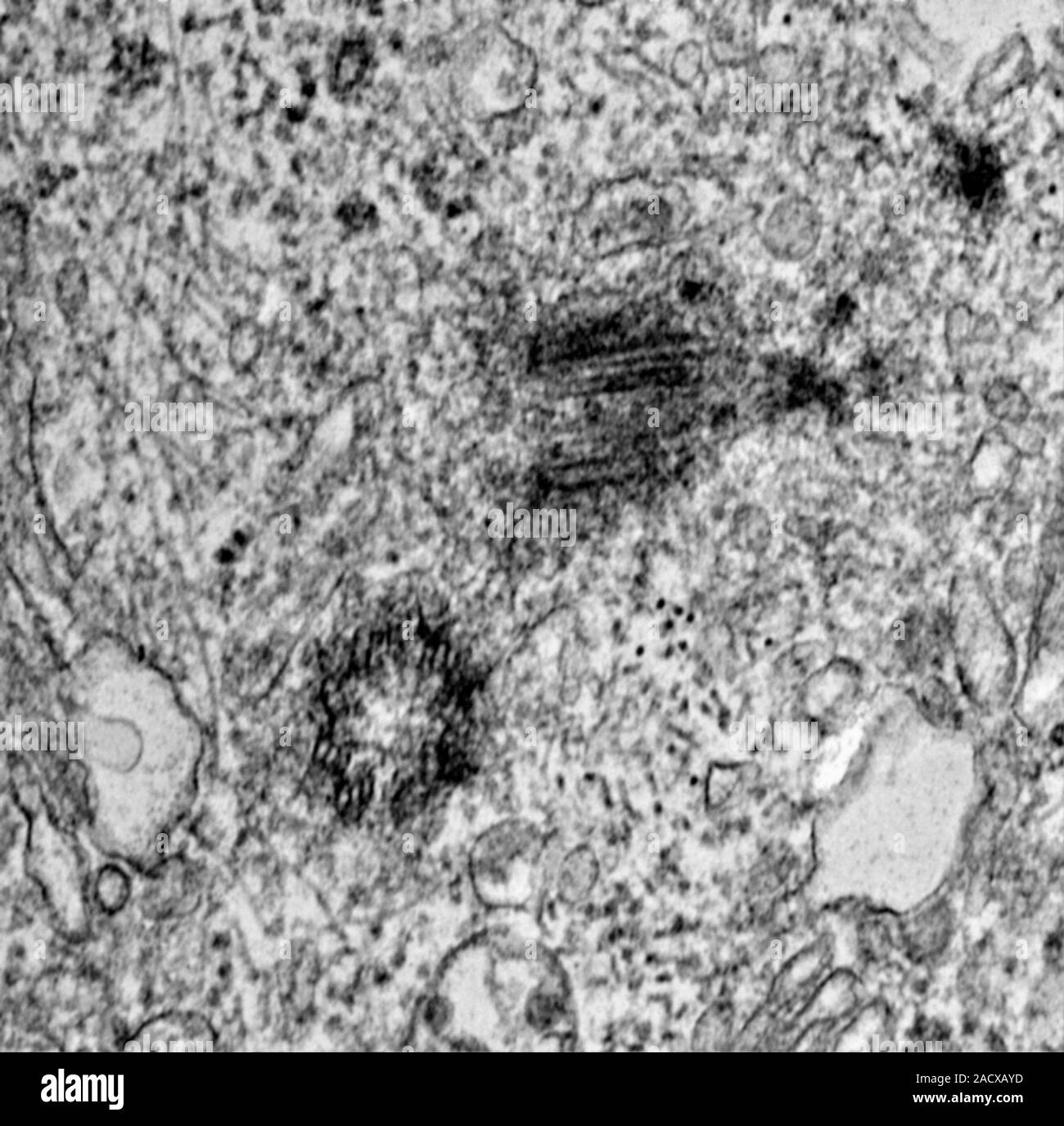Les centrioles, micrographie électronique à transmission (TEM). Les centrioles (structures ...