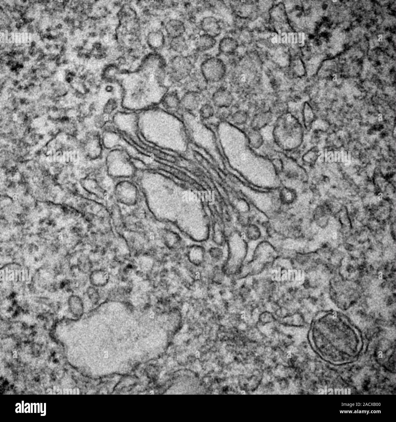 L'appareil de Golgi, micrographie électronique à transmission (TEM ...
