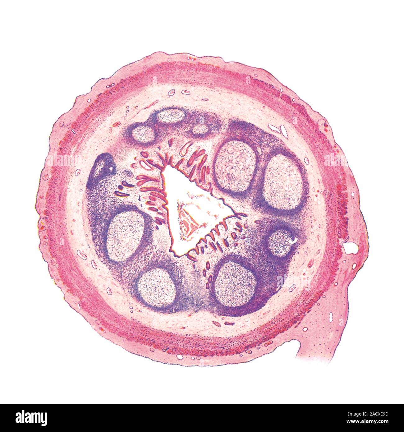 Illustration de la section transversale de l'appendice vermiforme ...