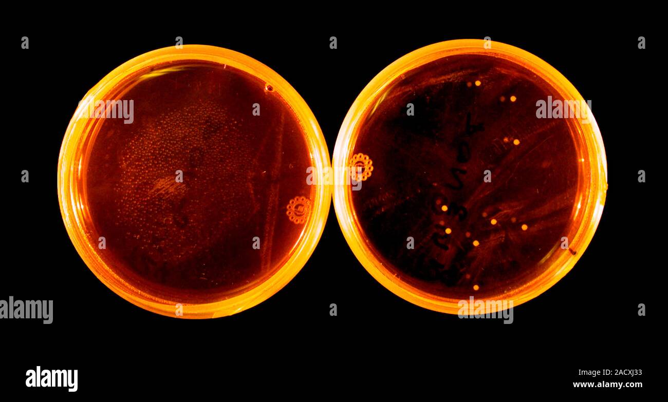 Le bactériophage-Salmonella expérience. Pétri de cultures de tissus ...