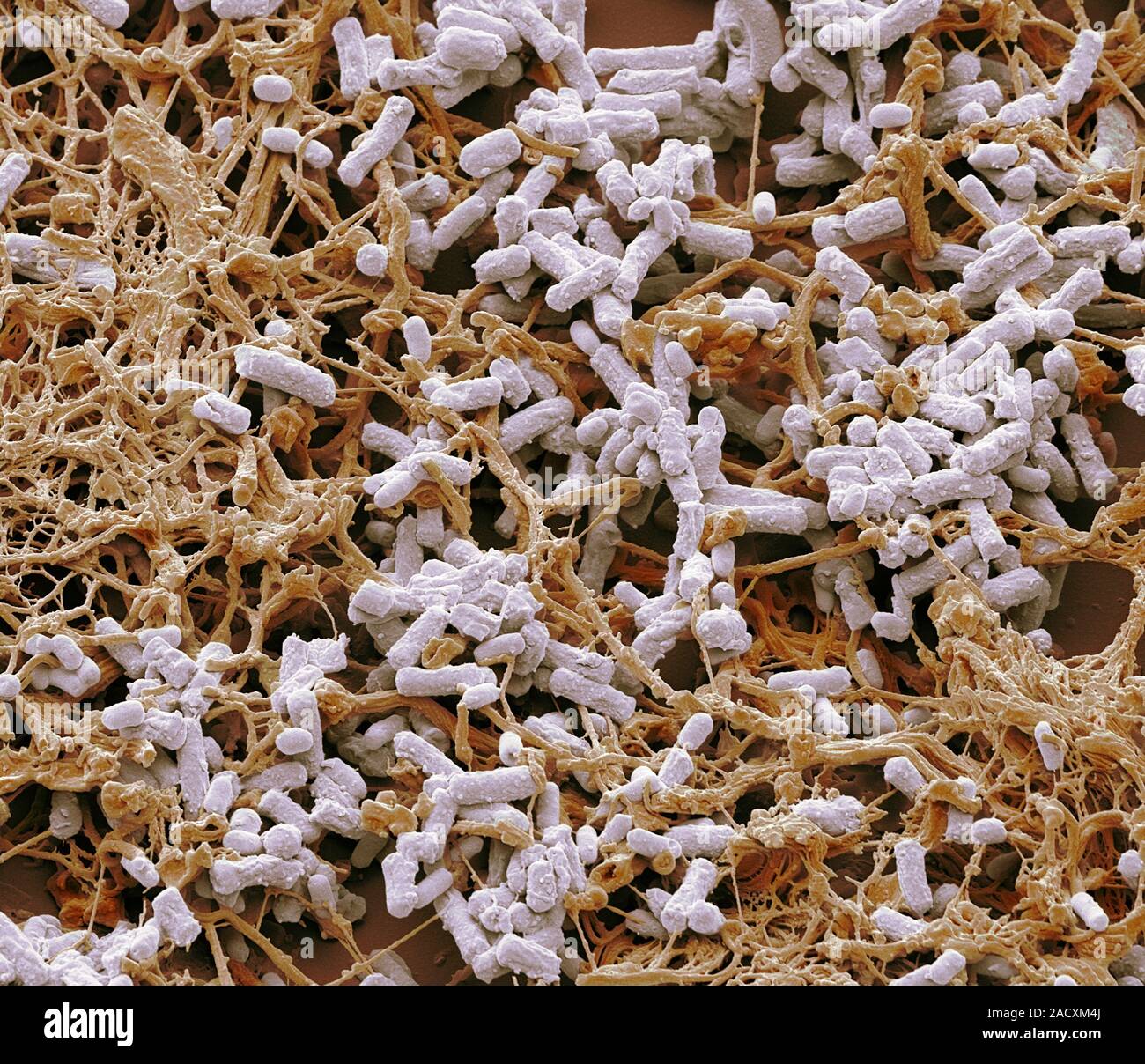 La colite. Couleur de l'analyse des électrons Microphotographie (SEM) d ...