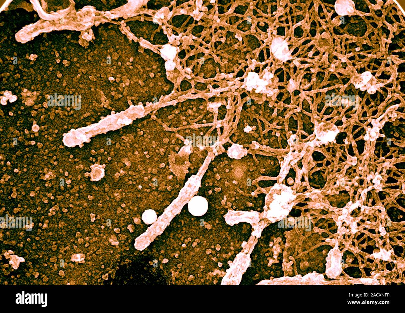 Le cytosquelette cellulaire, coloré et d'une inversion de micrographie ...
