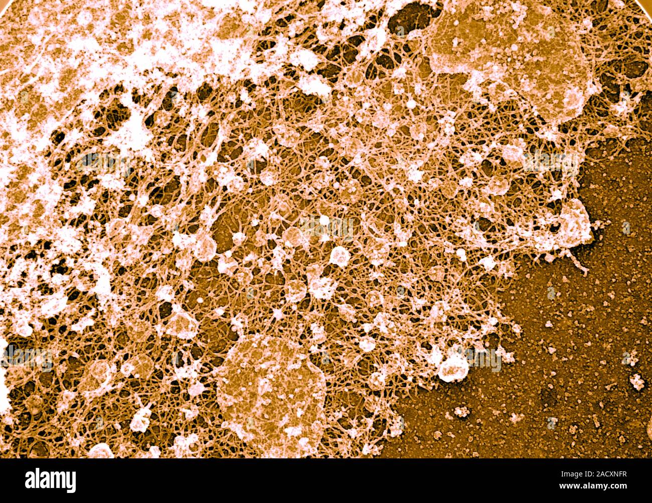 Le cytosquelette cellulaire, coloré et d'une inversion de micrographie ...