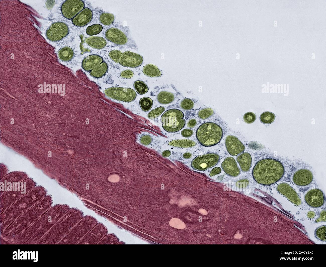 Des bactéries sur la surface de la langue. Micrographe de couleur (TEM ...