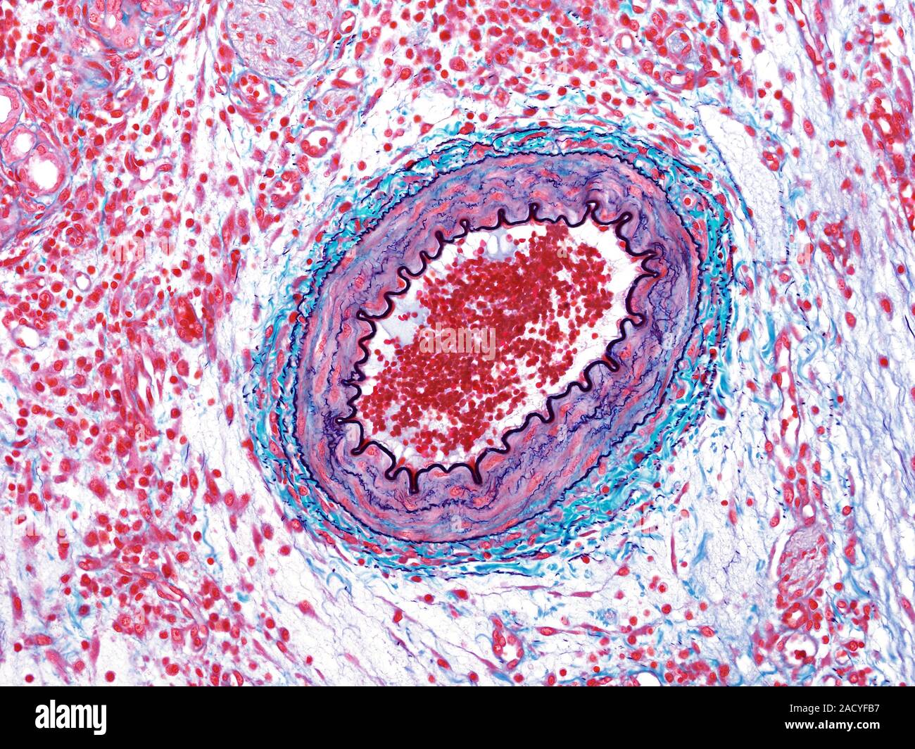 Petite artère musculaire. Microphotographie lumière d'une section à ...