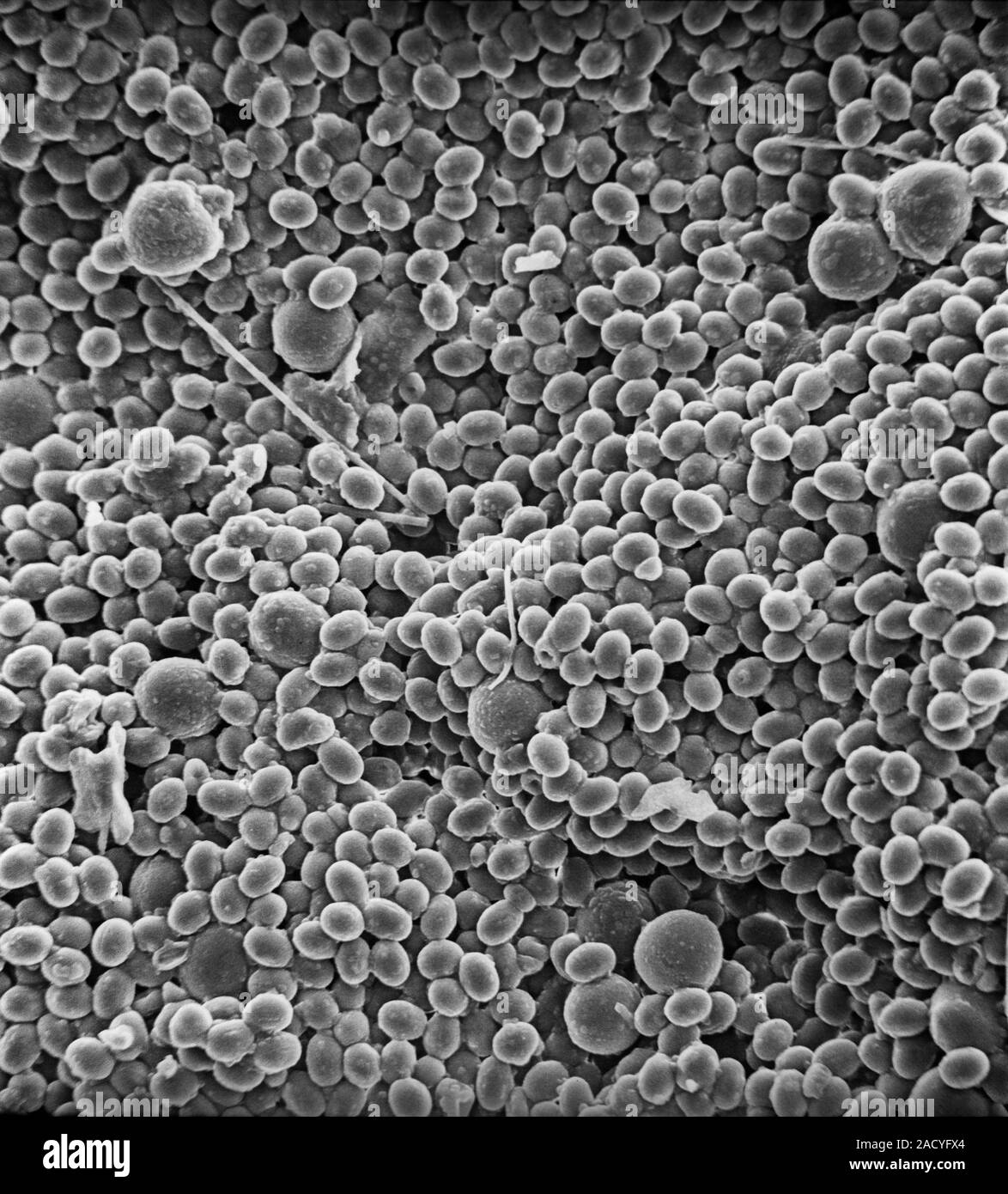 Microscope électronique à balayage (MEB) image de pollen sur l'abeille ...