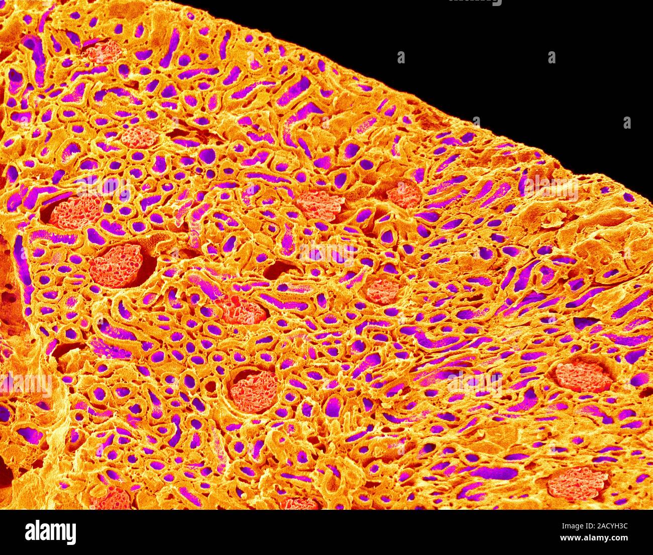 Les glomérules rénaux. Couleur de l'analyse des électrons ...