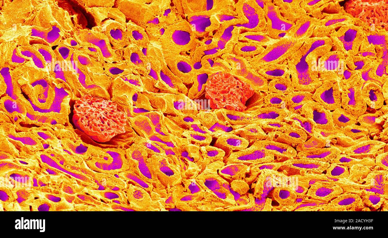 Les glomérules rénaux. Couleur de l'analyse des électrons ...