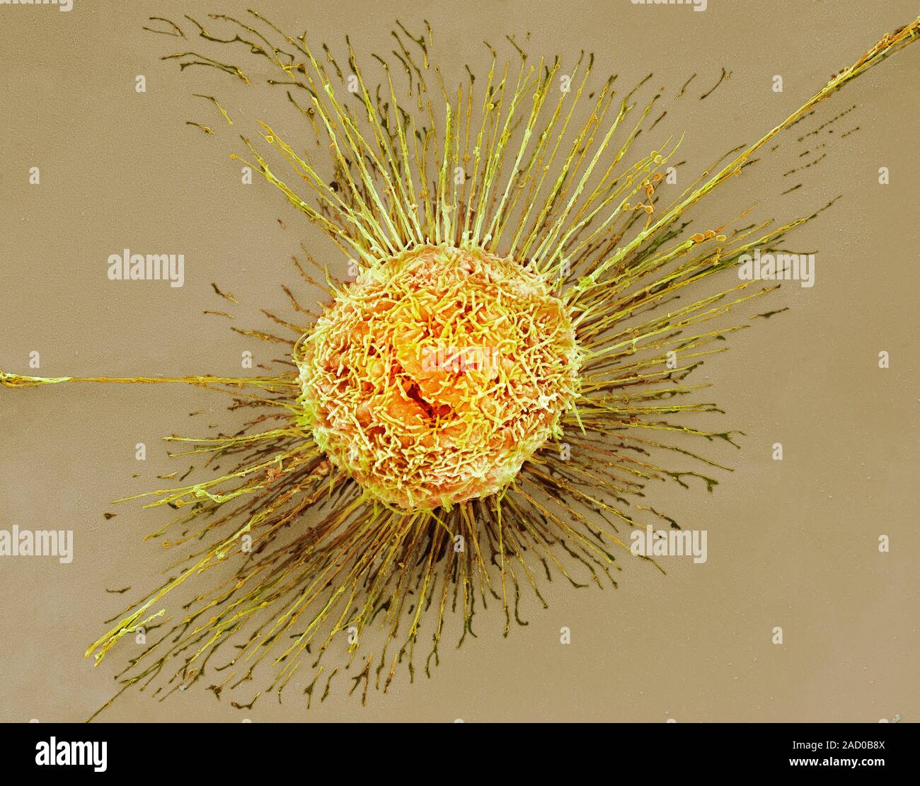 Les cellules épithéliales pulmonaires. Couleur de l'analyse des ...