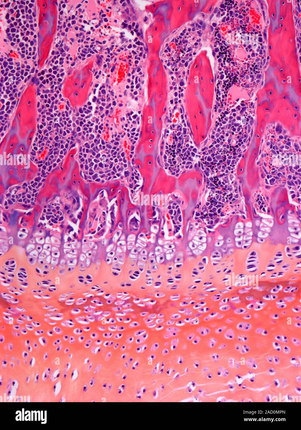 La croissance de l'os, la lumière Microphotographie d'une section de la ...