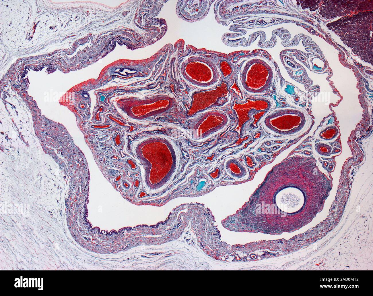 Cordon spermatique. Microphotographie lumière d'une section à travers ...