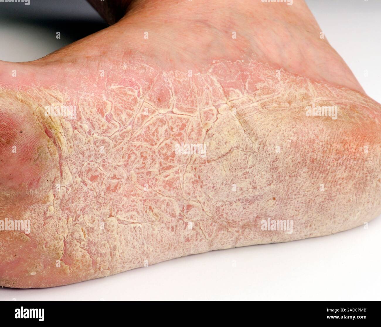 Ne pas utiliser à la télévision pas pour l'usage de la télévision dans ...