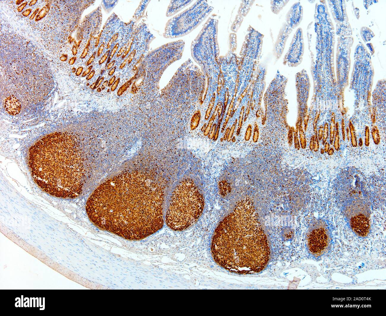 La microscopie optique des follicules lymphoïdes dans un patch de Peyer ...