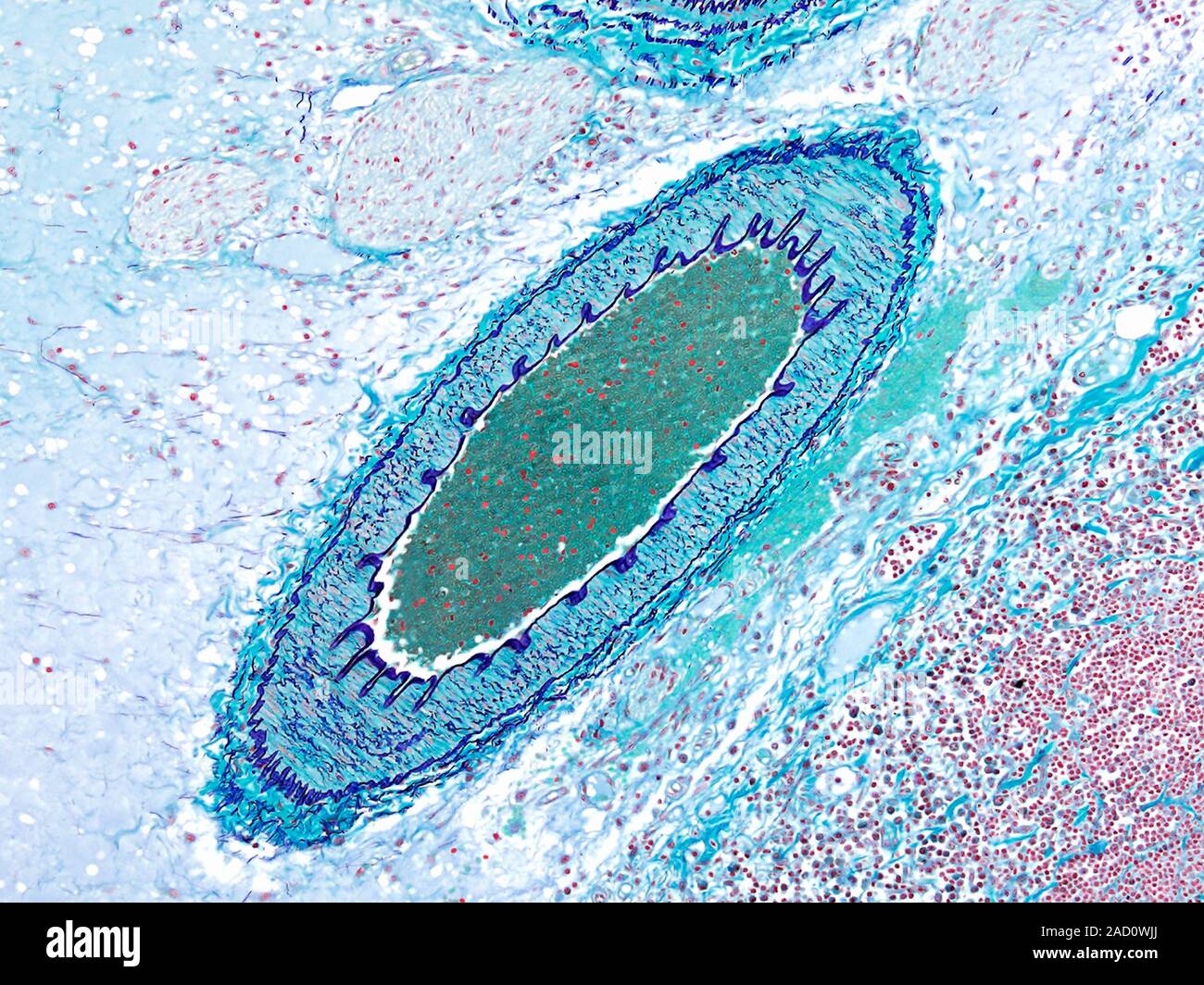 La microscopie optique d'un artère musculaire sectioned dans un plan ...