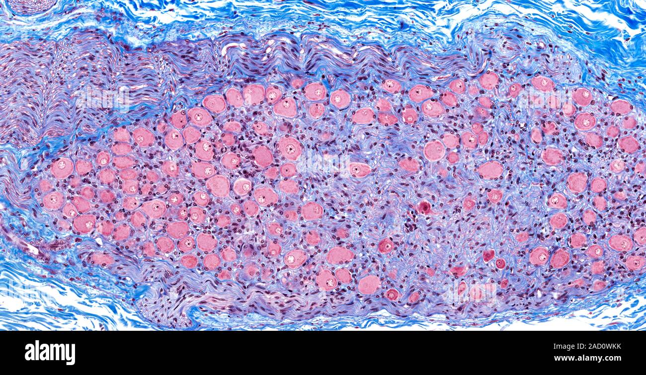 La microscopie optique d'un ganglion nerveux. Les ganglions sont des ...