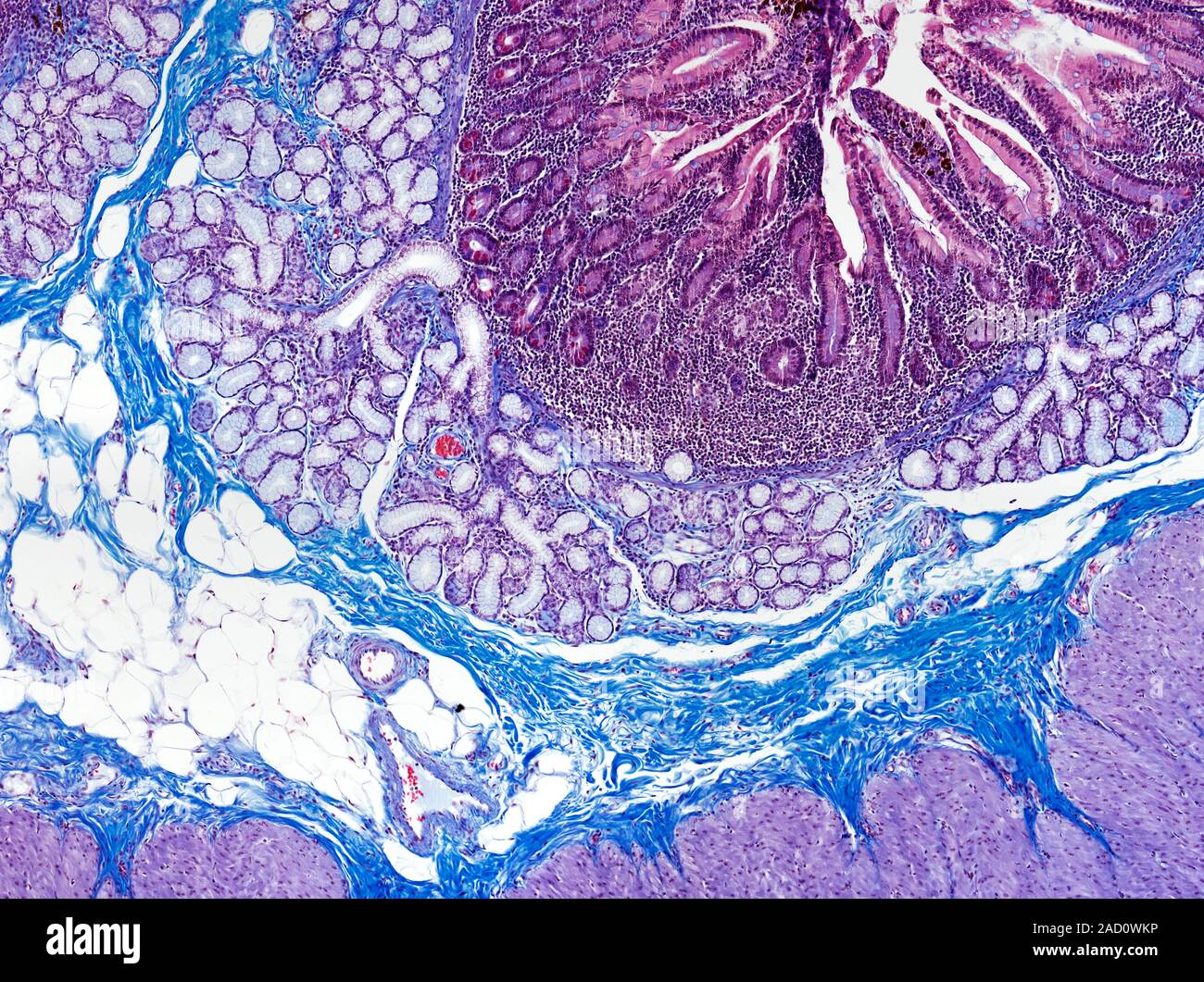 La microscopie optique de la paroi interne (muqueuse) de l'intestin ...