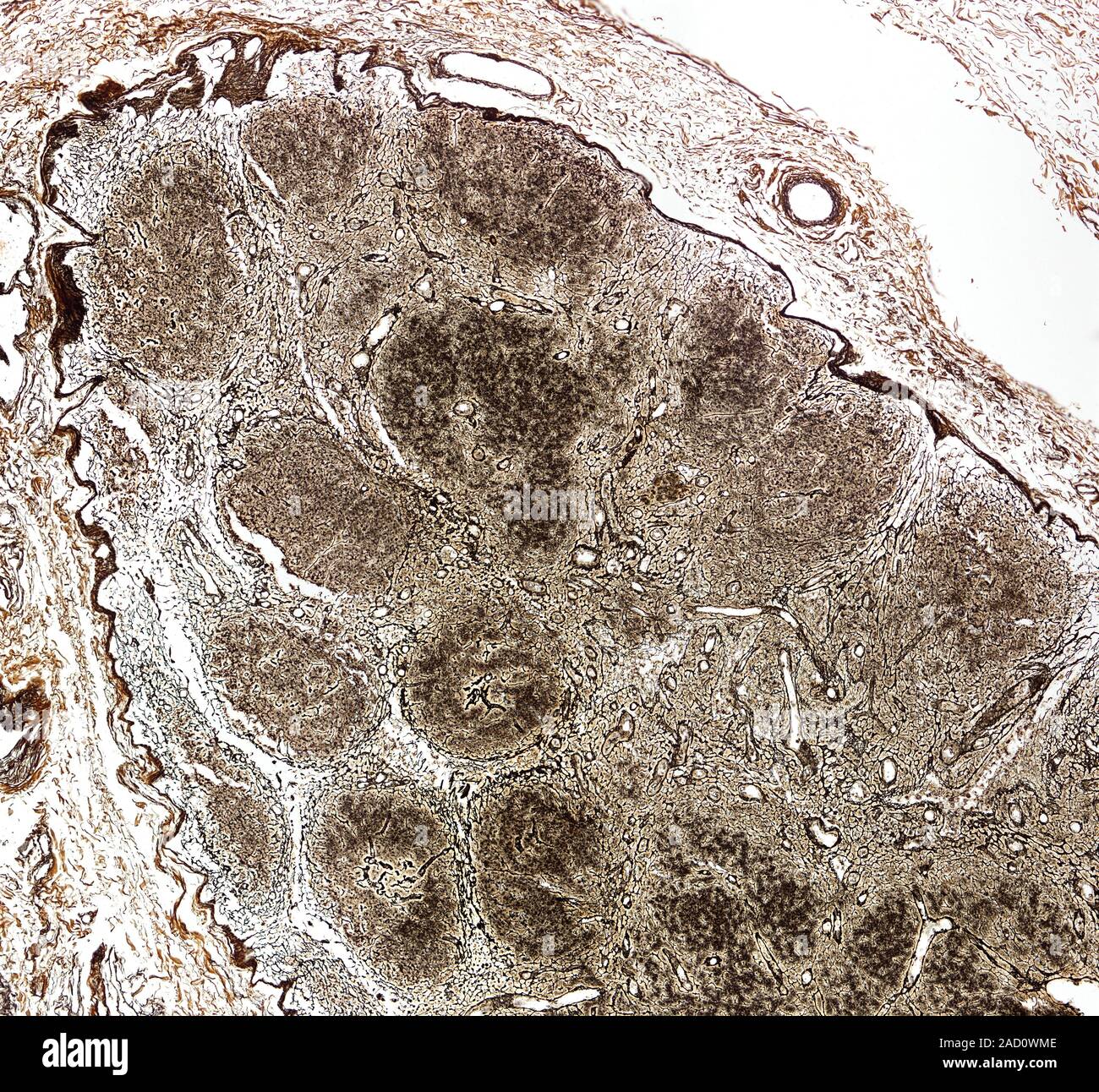 La microscopie optique d'un vitrail de noeud de lymphe de montrer le ...