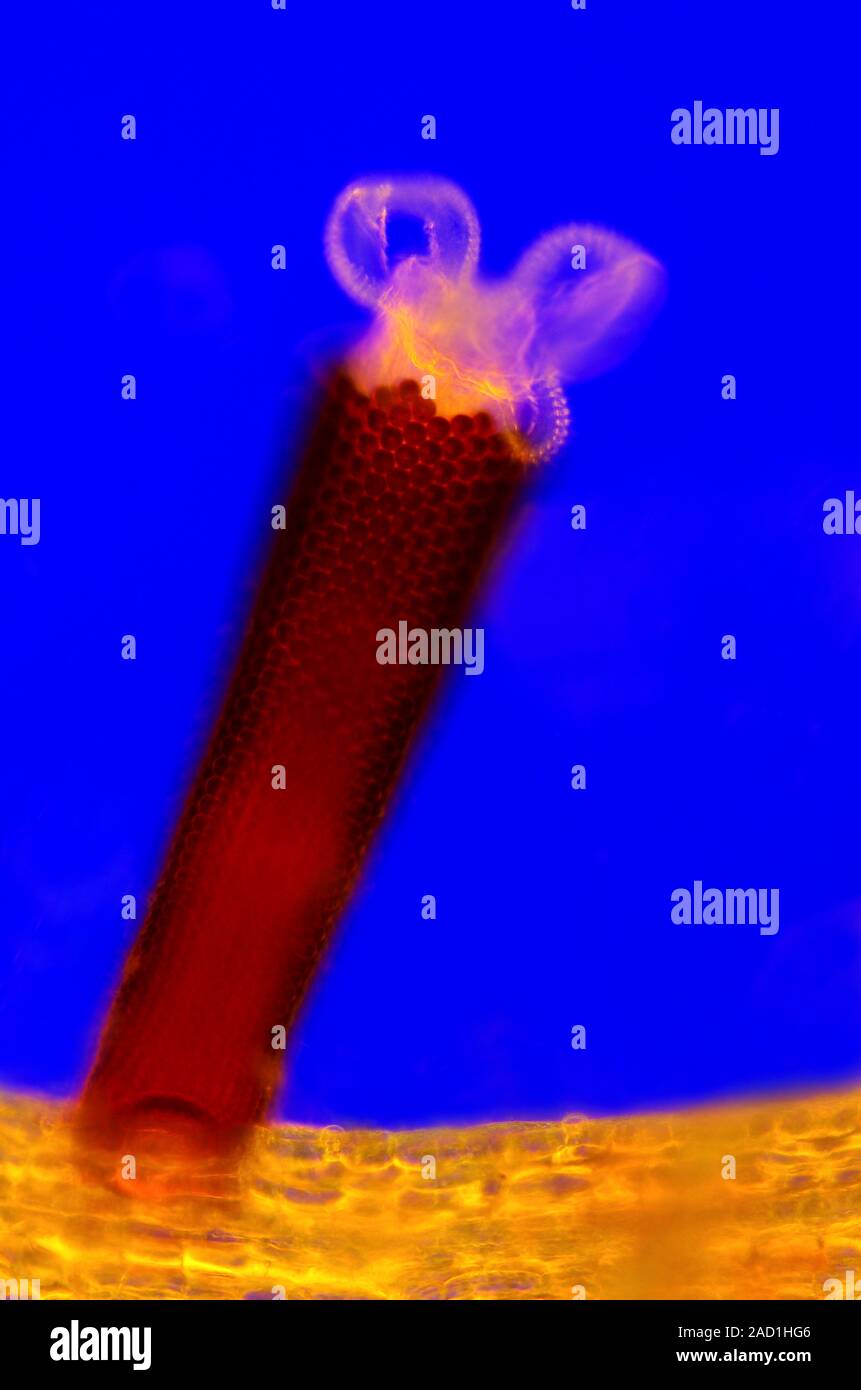 Floscularia rotifère. Rheinberg allumé la lumière Microphotographie d ...