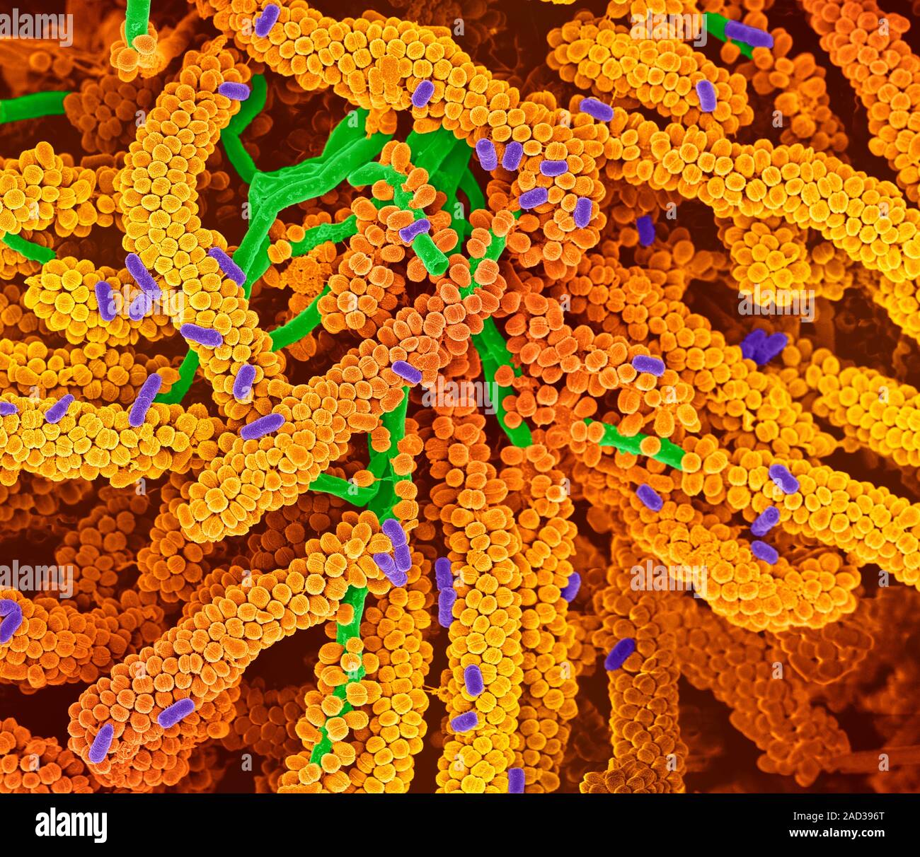 Les bactéries Streptococcus. Couleur de l'analyse des électrons ...