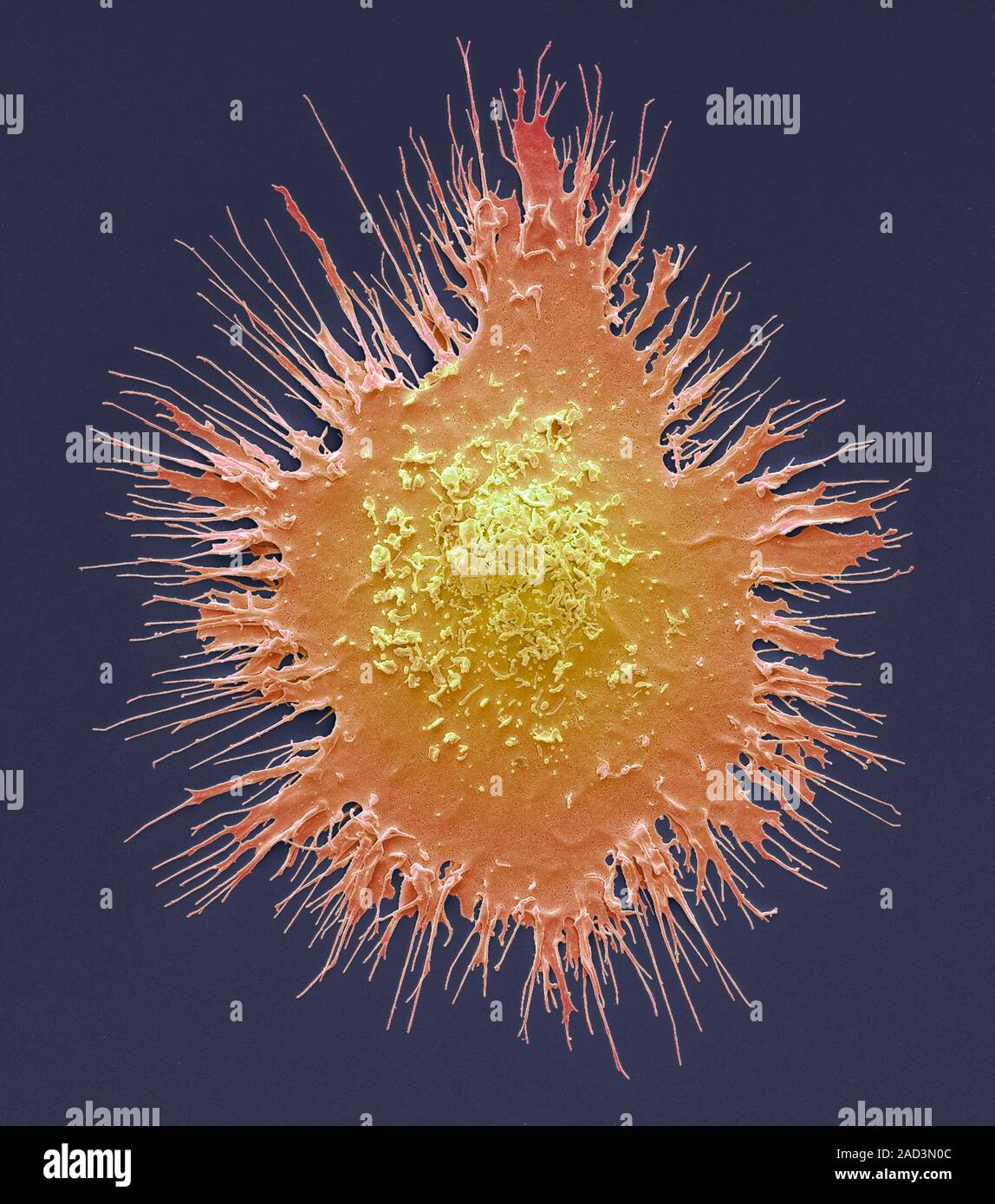 Les cellules dendritiques. Couleur de l'analyse des électrons ...