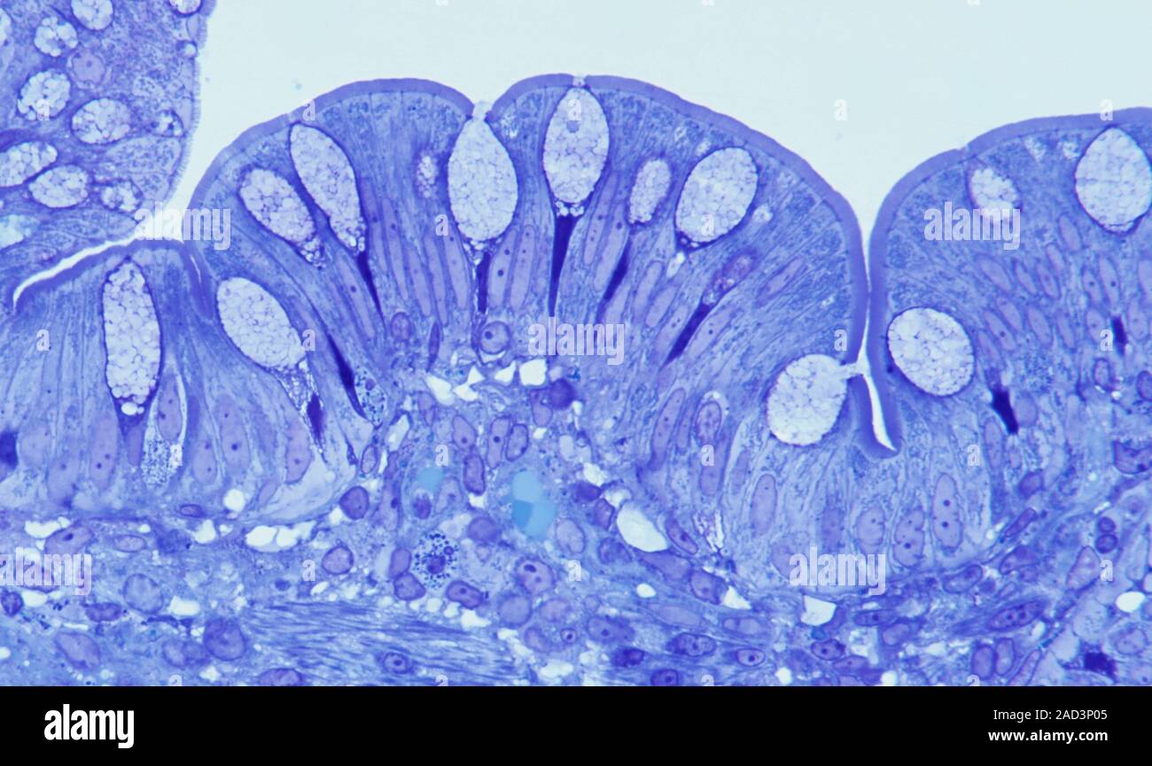 La microscopie optique d'épithélium de l'intestin grêle montrant les ...