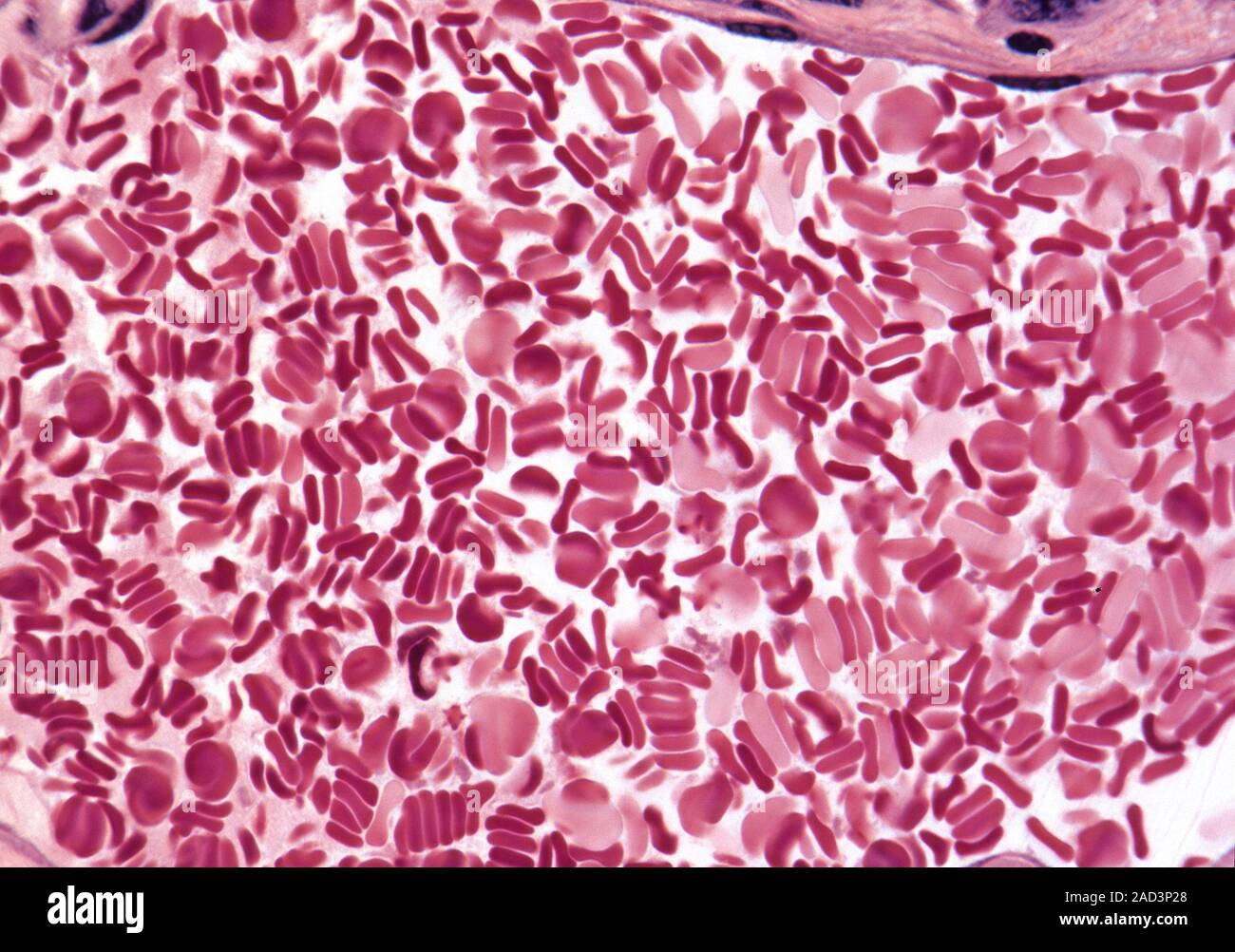 La microscopie optique des globules rouges (érythrocytes) dans un ...